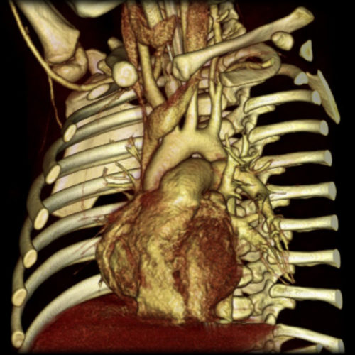 CT画像 / 3D処理 | 診療放射線技師国家試験 対策ノート